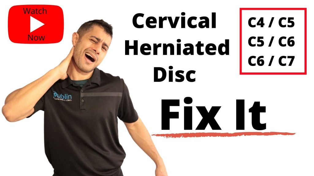Cervical herniated disc exercises – Dublin Sports Injury Clinic